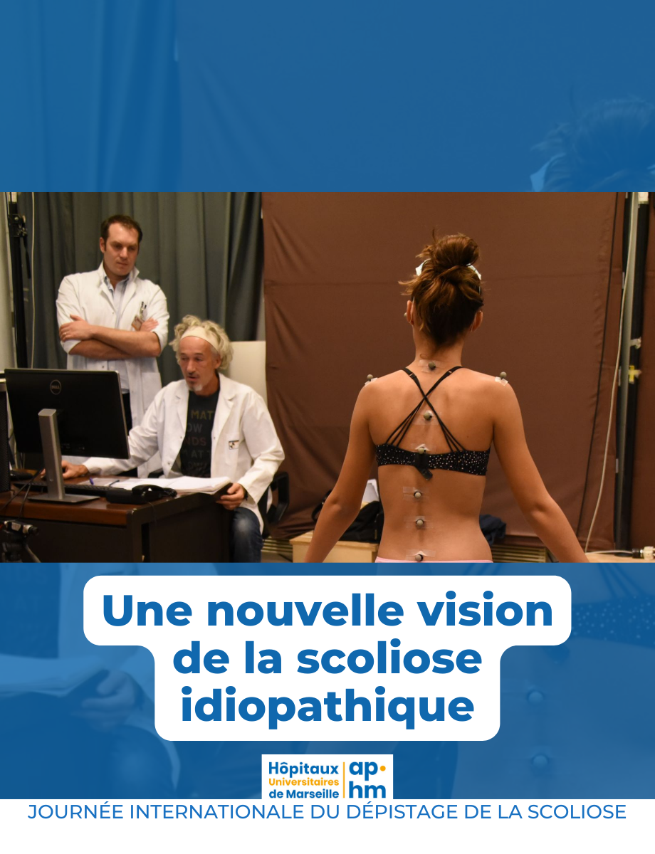 Une nouvelle vision de la scoliose idiopathique | AP-HM