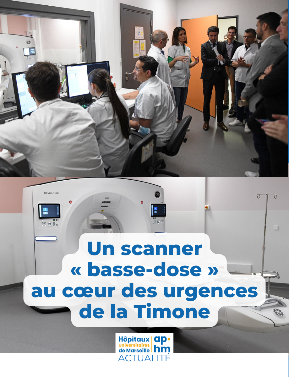 Un scanner « basse-dose » au cœur des urgences de la Timone | AP-HM
